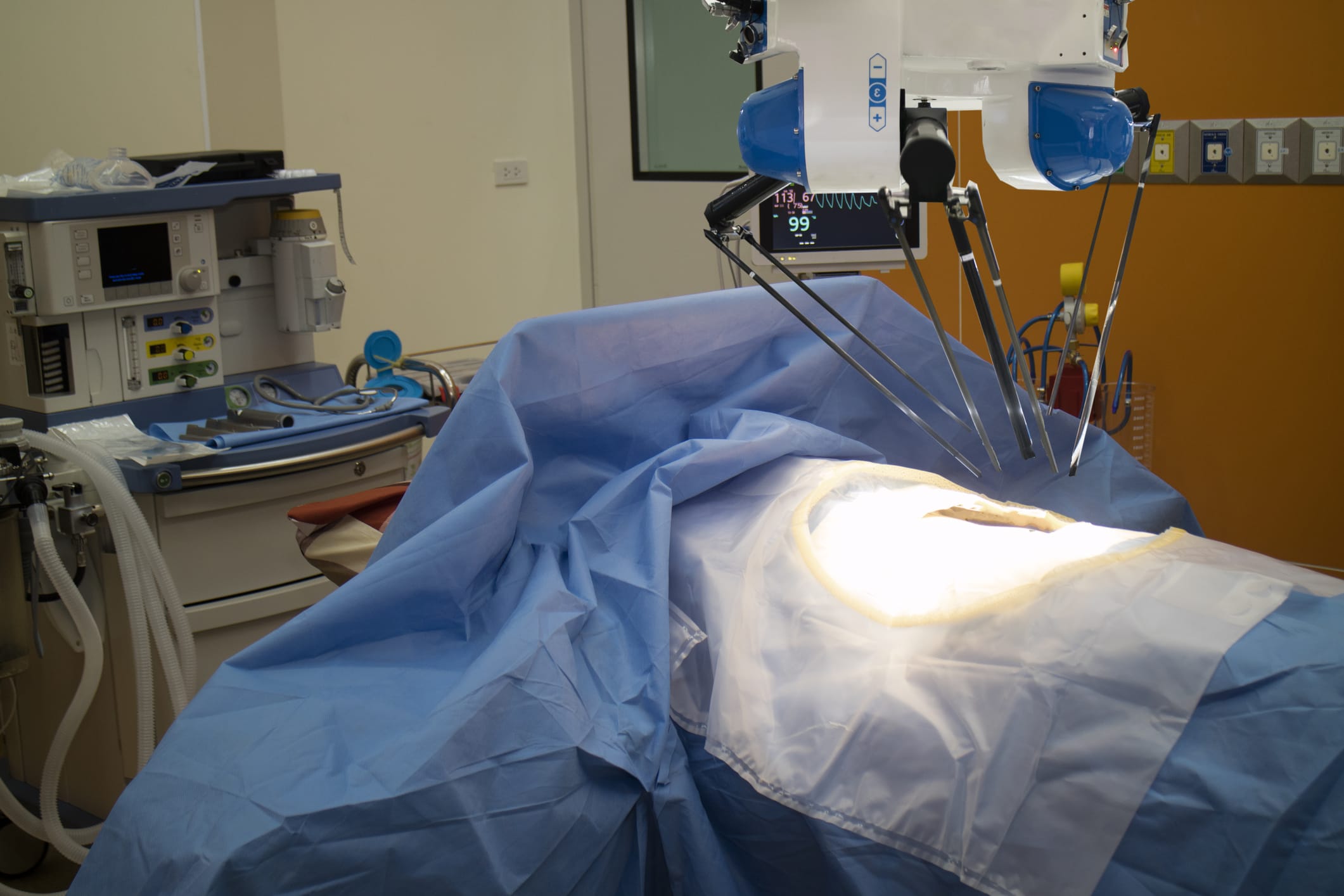 Robotic Surgery and Infection Control: Enhancing Precision, Safety ... Robotic Surgery and Infection Control: Enhancing Precision, Safety ...